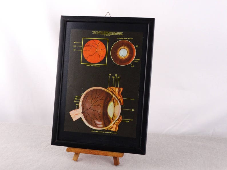 Eye Anatomy Ophthalmology Poster Human Anatomy Print - Etsy