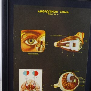 Human Eye Anatomy Poster, Ophthalmology Print, Ophthalmology Poster ...