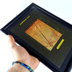 Human Skin Anatomy, Dermatology Poster, Anatomy Print, Medical Decor ...