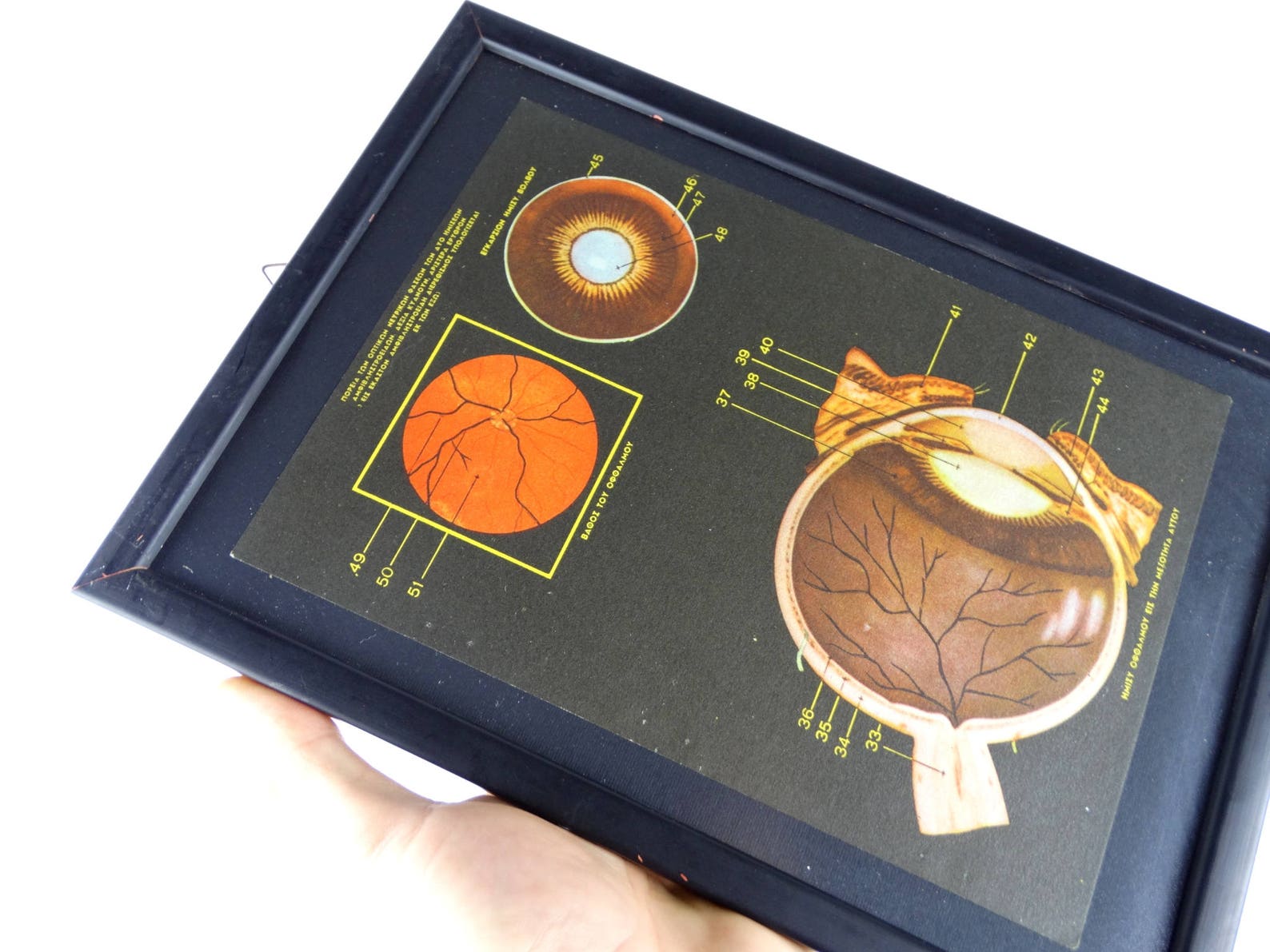 Eye Anatomy Ophthalmology Poster Human Anatomy Print | Etsy