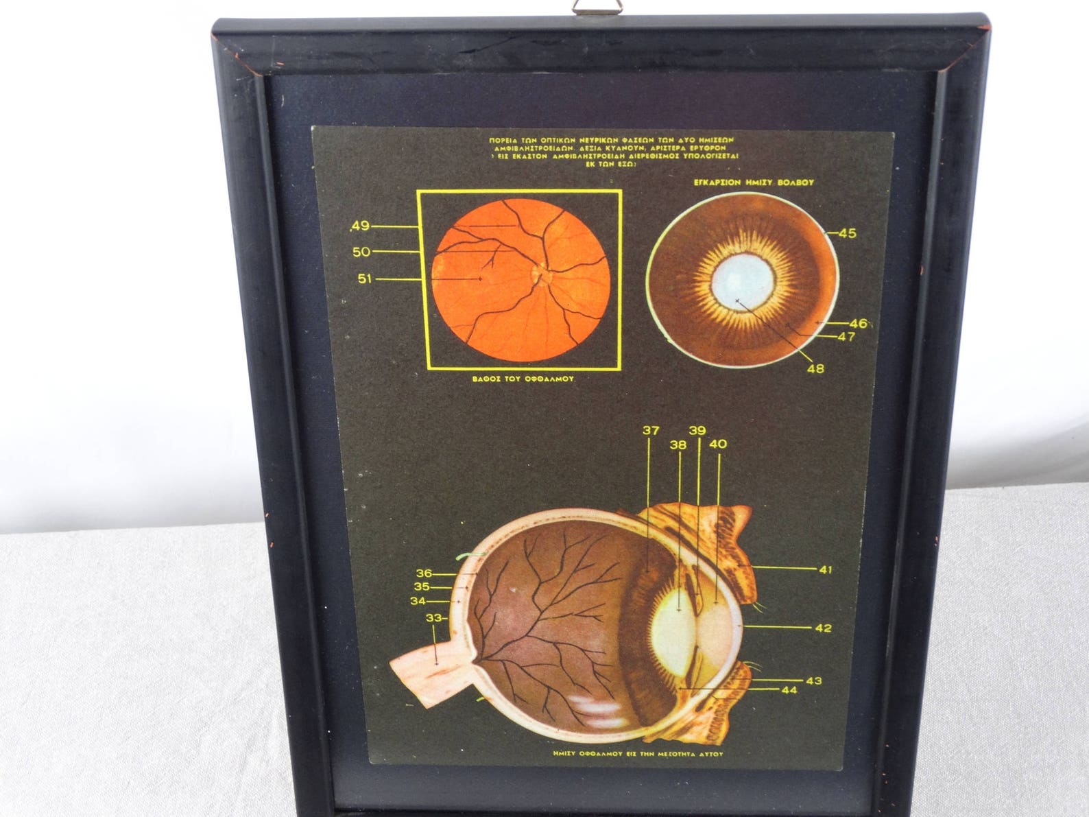 Eye Anatomy Ophthalmology Poster Human Anatomy Print - Etsy
