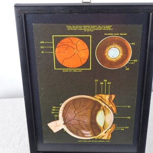 Eye Anatomy, Ophthalmology Poster, Human Anatomy Print, Ophthalmology ...