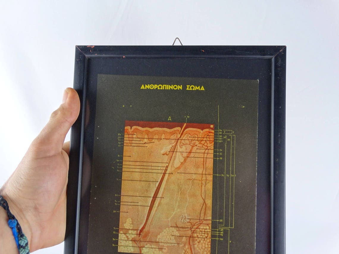 Human Skin Anatomy Dermatology Poster Anatomy Print Medical | Etsy