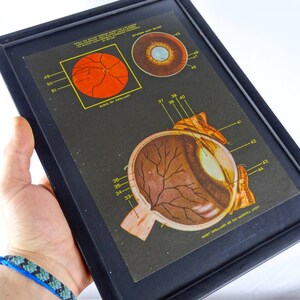 Eye Anatomy, Ophthalmology Poster, Human Anatomy Print, Ophthalmology ...