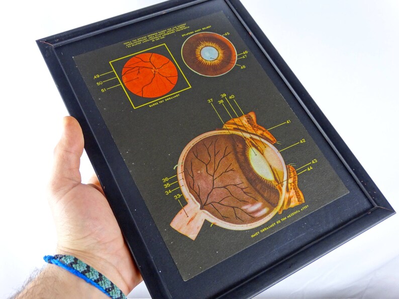 Eye Anatomy Ophthalmology Poster Human Anatomy Print | Etsy
