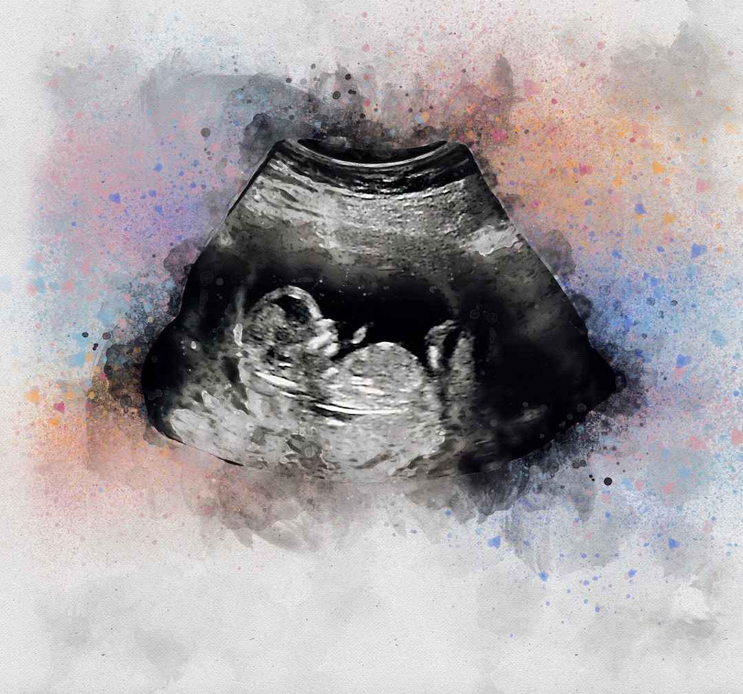 Baby Ultrasound Art,, Watercolor Sonogram Print, Baby Shower Gift ...