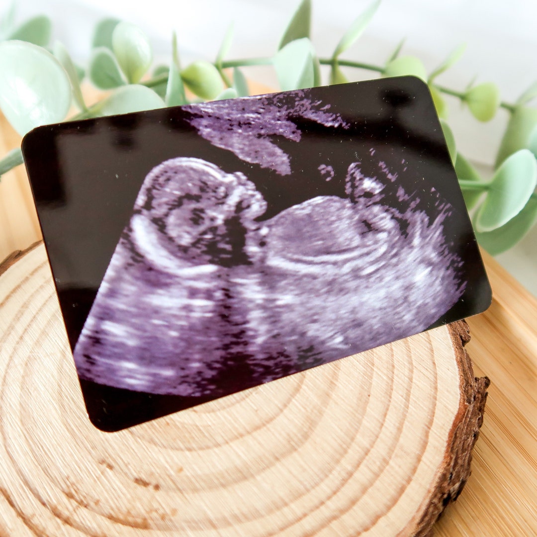 Baby Scan Gift Baby Scan Wallet Card Insert Sonogram Gift New Daddy ...
