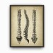 Vintage Spine Art Print, Human Spine, Spine Anatomy Poster, Anatomical ...