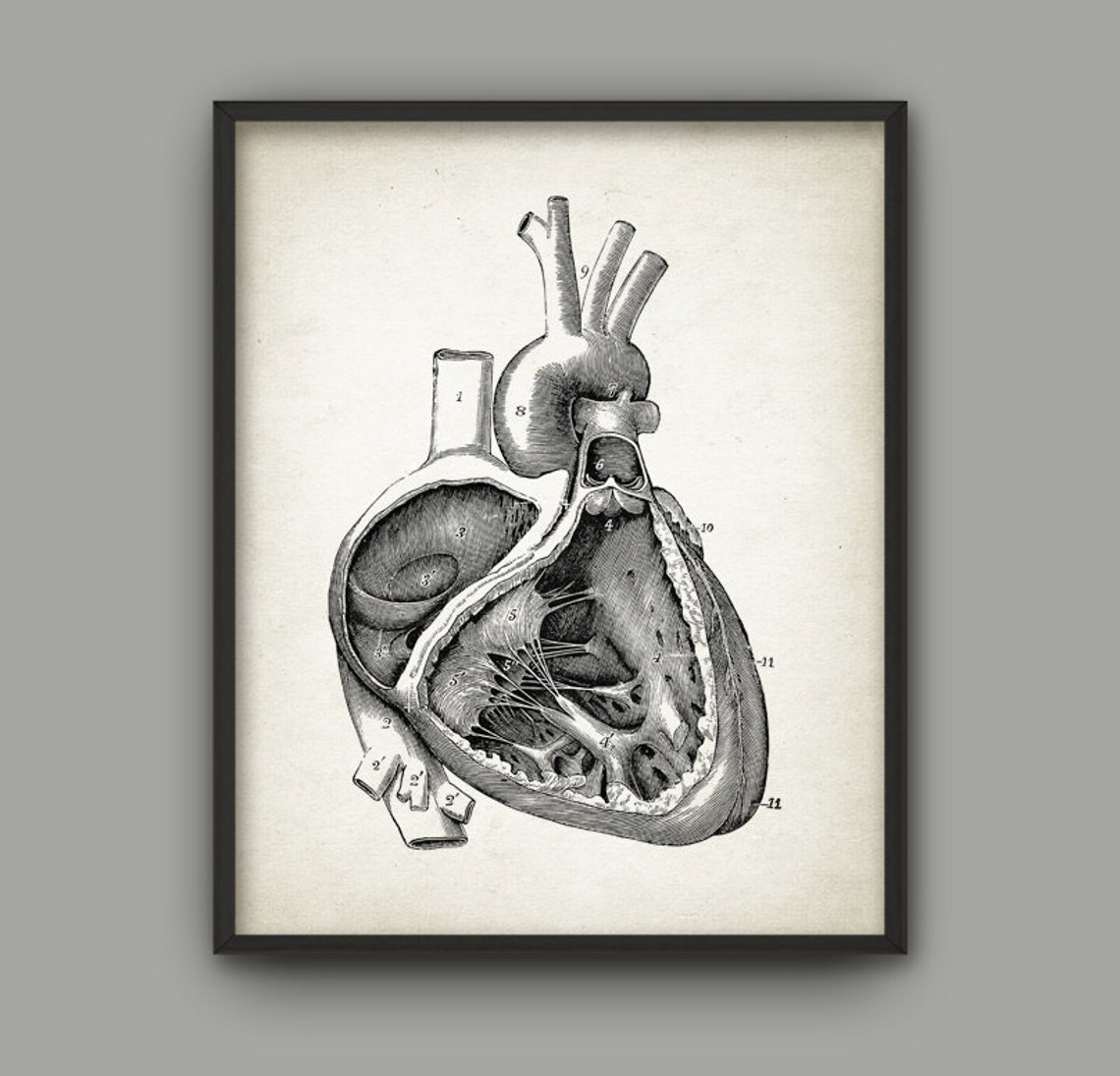Heart Anatomy Print Set of 3 - Human Heart - Left and Right Auricle ...