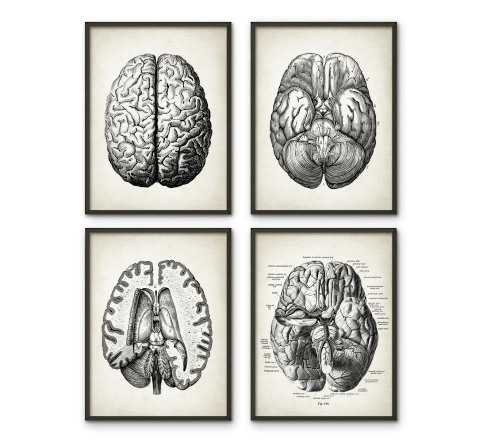 Human Brain Anatomy Print Set of 4 Brain Dissection Vintage Brain ...