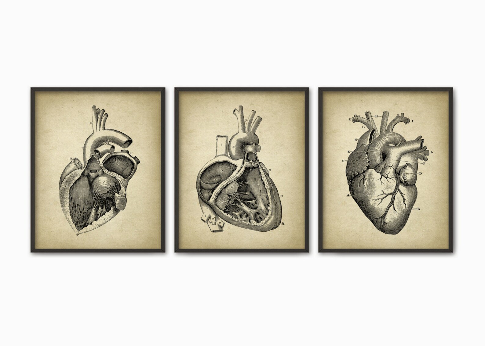 Heart Anatomy Print Set of 3 - Human Heart - Left and Right Auricle ...