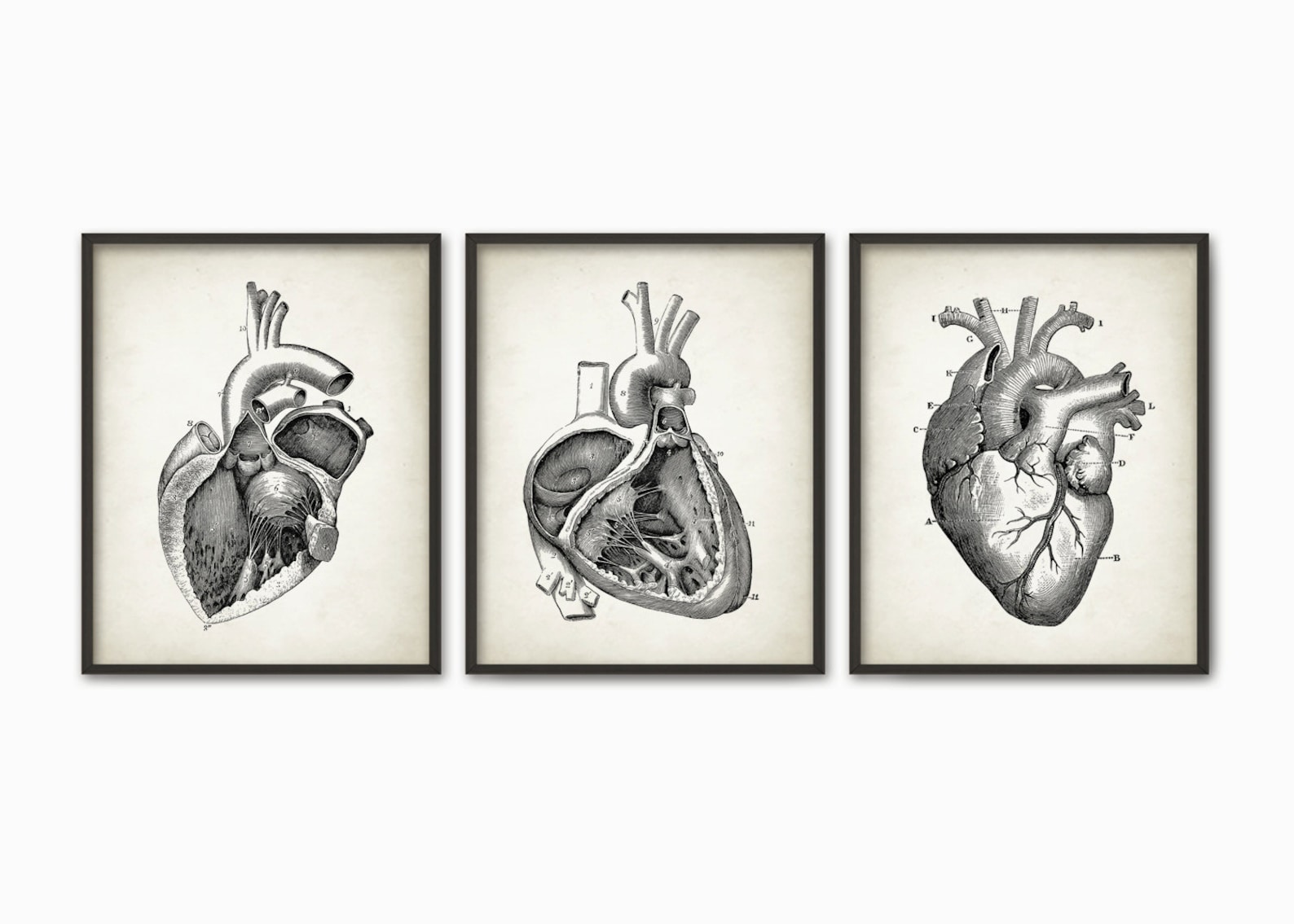 Heart Anatomy Print Set of 3 - Human Heart - Left and Right Auricle ...