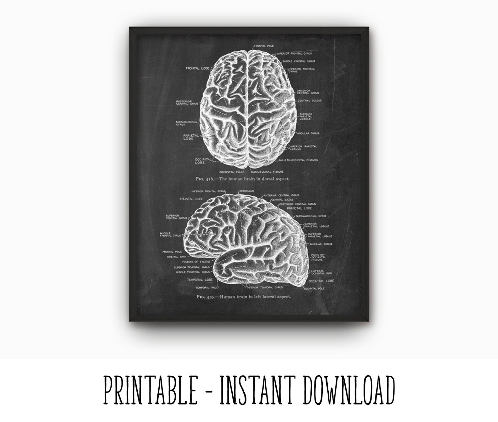 PRINTABLE Brain Anatomy Print Neuroscience Wall Art Poster - Etsy UK