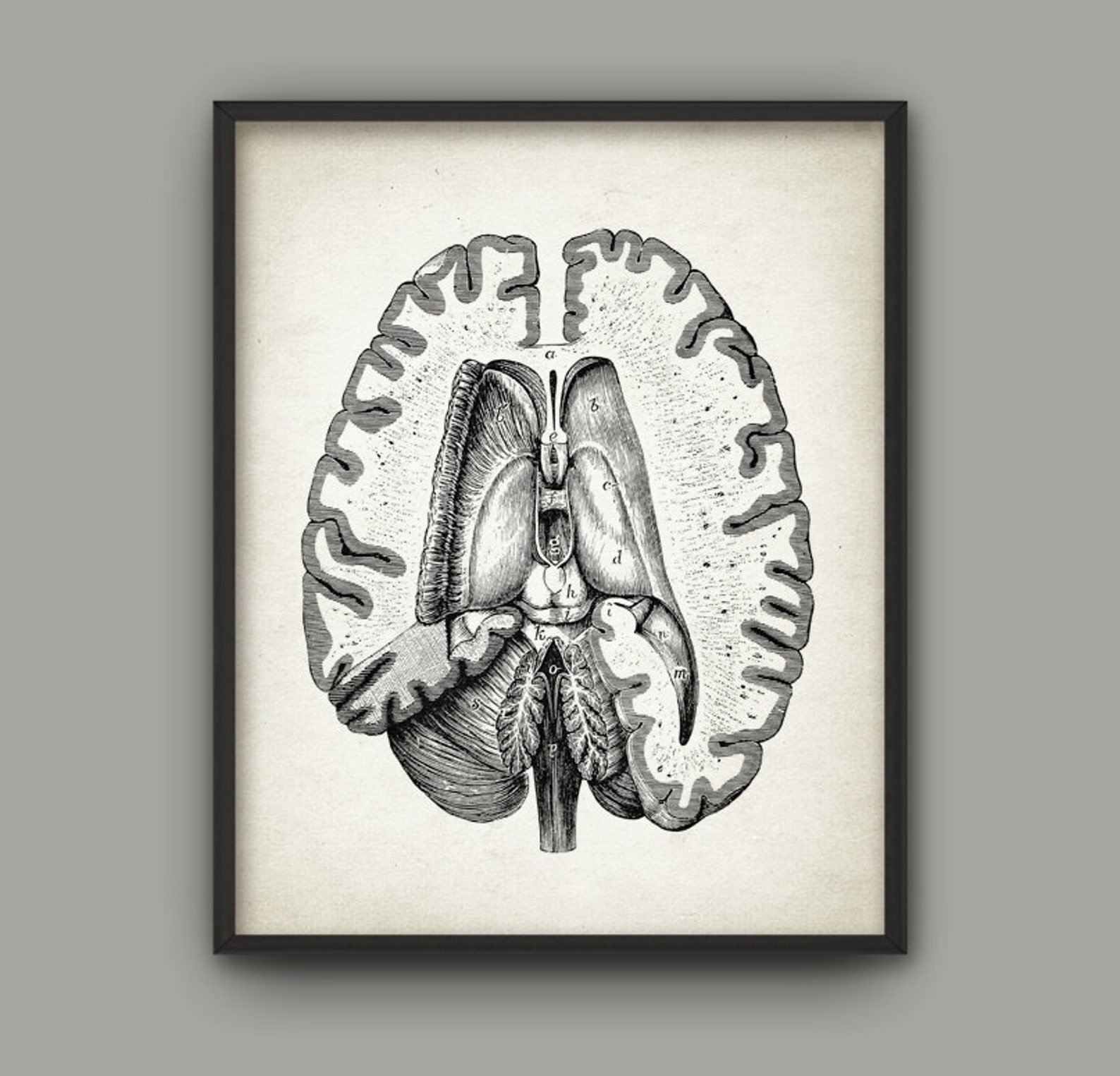 Human Brain Anatomy Print Set of 4 Brain Dissection Vintage Brain ...