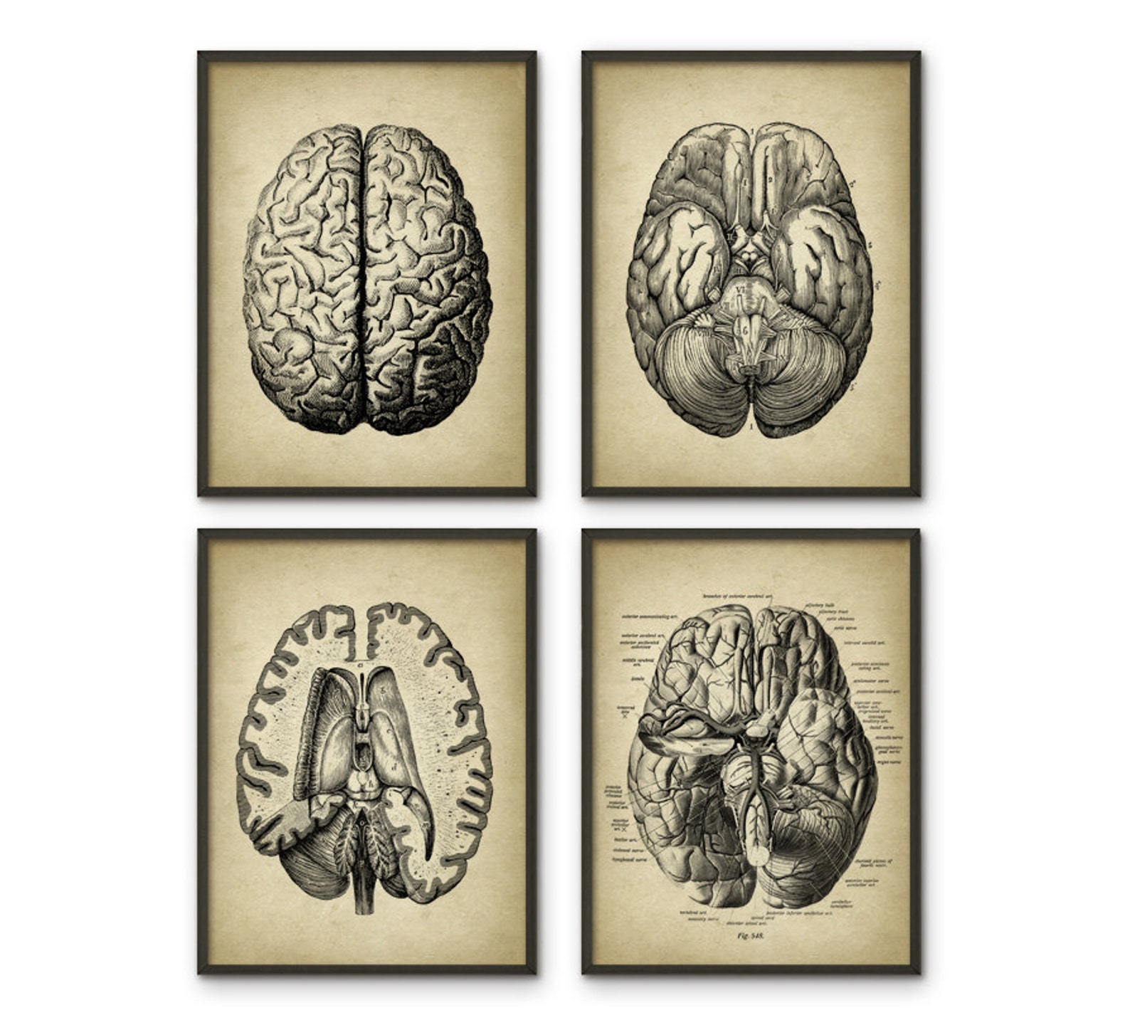Human Brain Anatomy Print Set of 4 Brain Dissection Vintage Brain ...