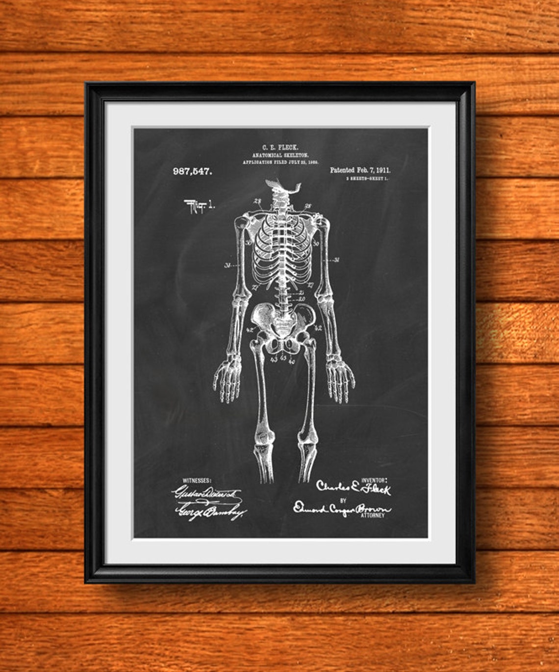 Retro 1911 Anatomical Skeleton Vintage Art Print Poster - Etsy