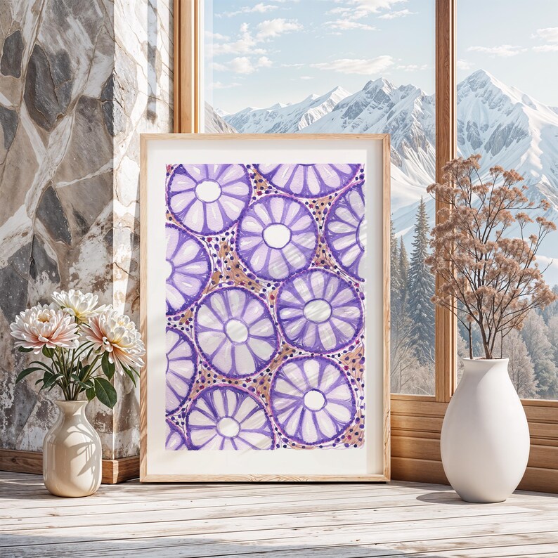 Colon Histology Watercolor Digital Art: Pathology Anatomy Decor ...