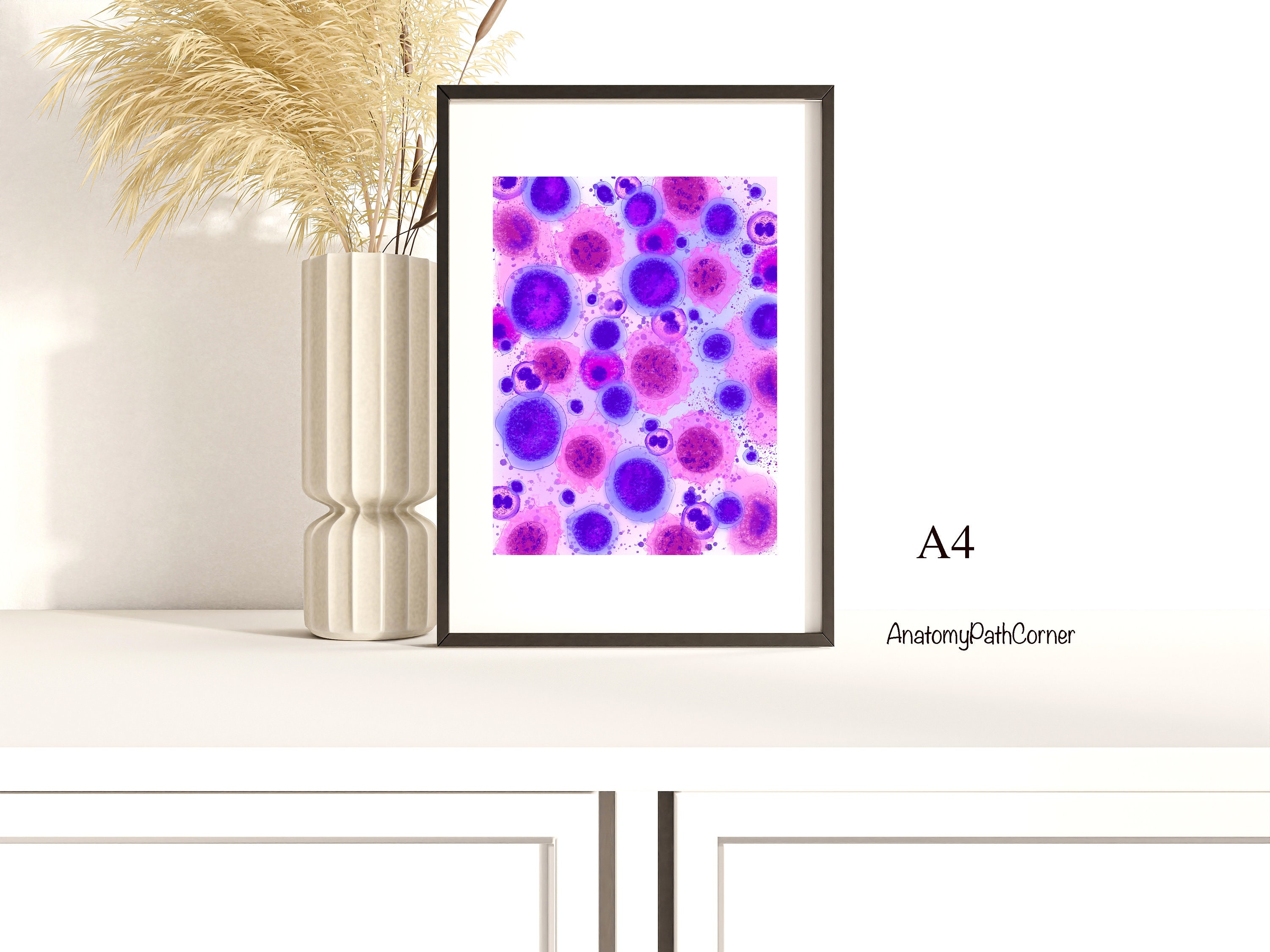 Histology Print, Wall Art, Cell Biology, Lymphoma Cells, Digital Art ...