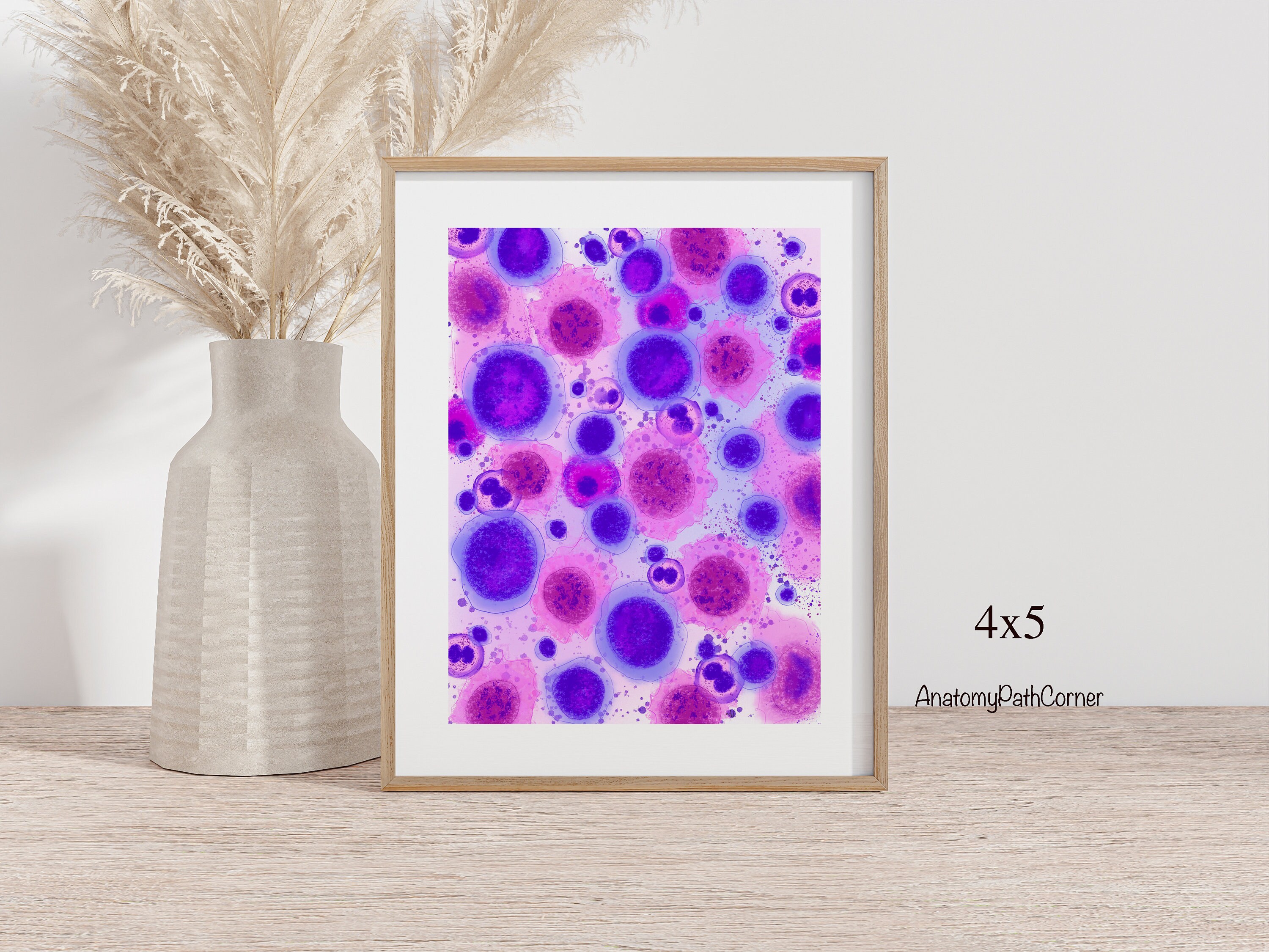 Histology Print, Wall Art, Cell Biology, Lymphoma Cells, Digital Art ...