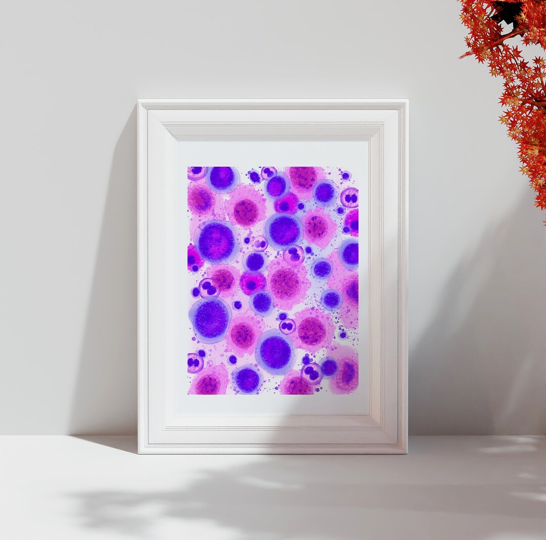 Histology Print, Wall Art, Cell Biology, Lymphoma Cells, Digital Art ...