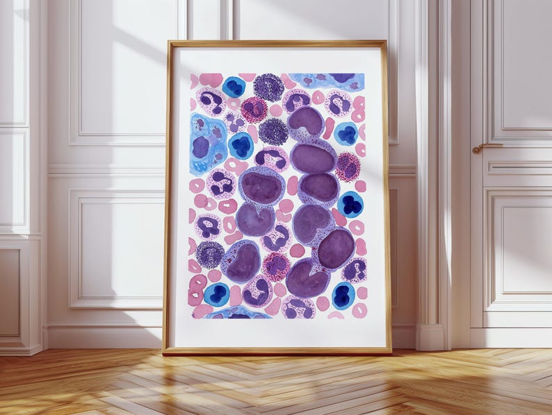 Chronic Myeloid Leukemia Watercolor Digital Art: Hematology Pathology ...