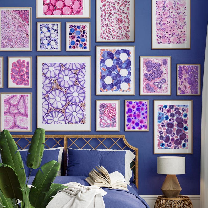 Colon Histology Watercolor Digital Art: Pathology Anatomy Decor ...