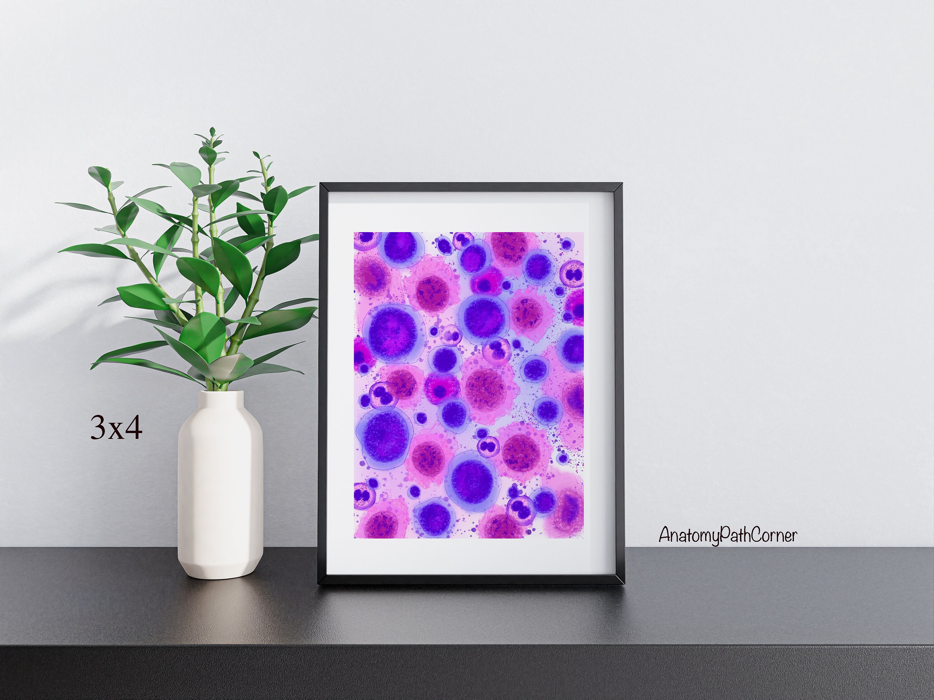Histology Print, Wall Art, Cell Biology, Lymphoma Cells, Digital Art ...