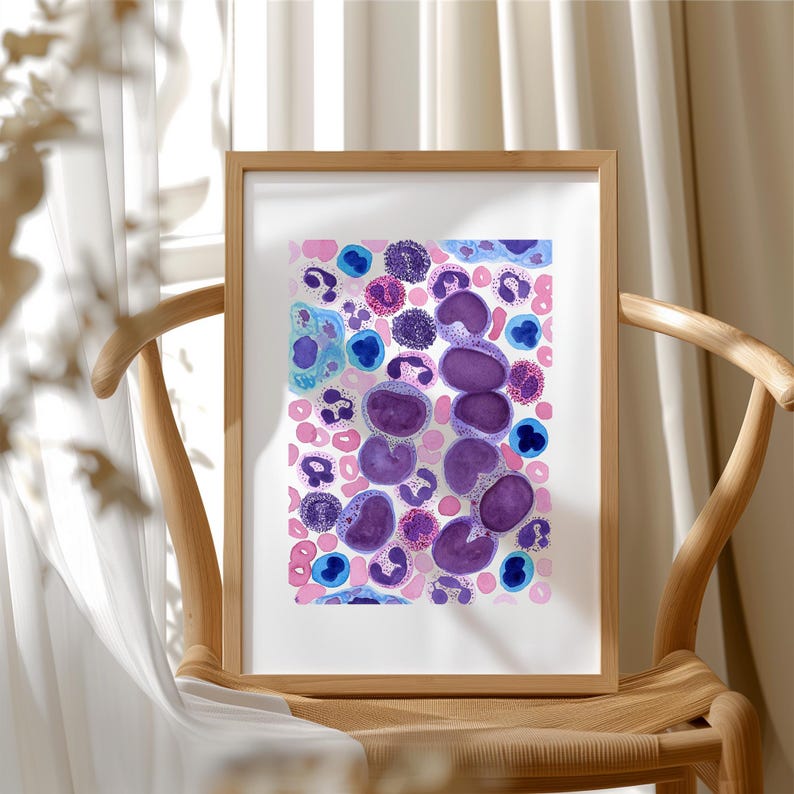 Chronic Myeloid Leukemia Watercolor Digital Art: Hematology Pathology ...