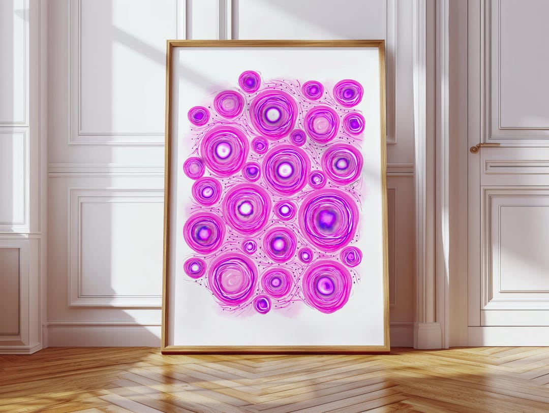Meningioma Histology Art, Brain Tumor Histology, Histology Art, Digital ...