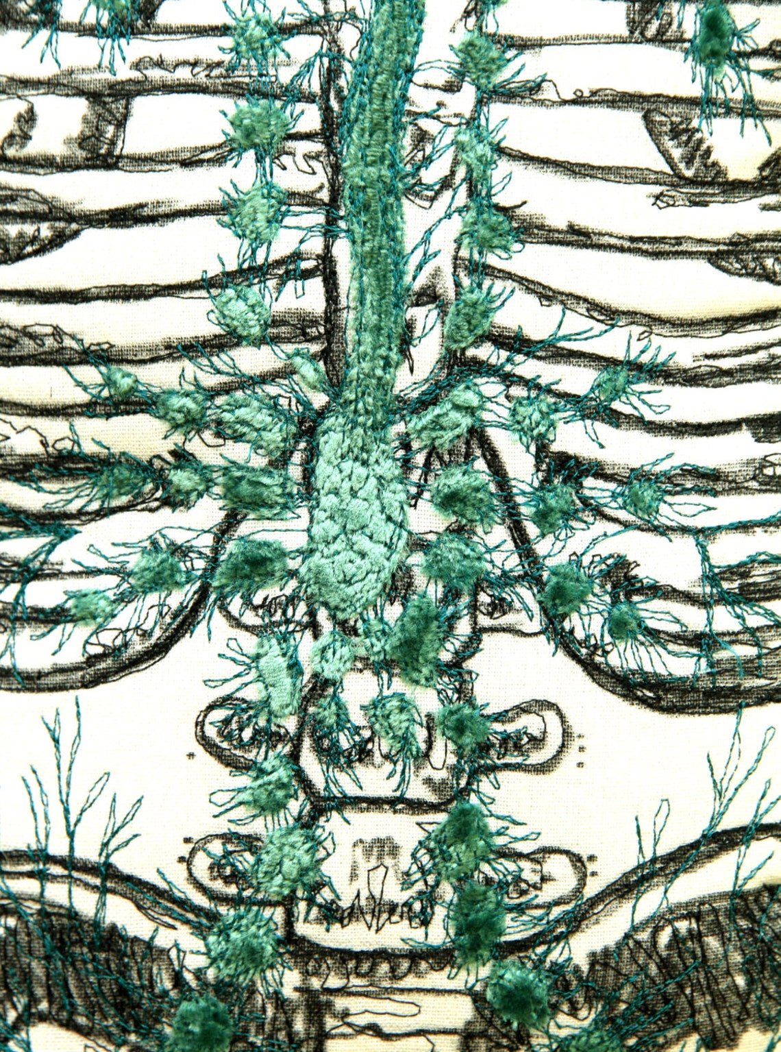 Cadaverous Cavities - Torso With Lymphatic System - Etsy