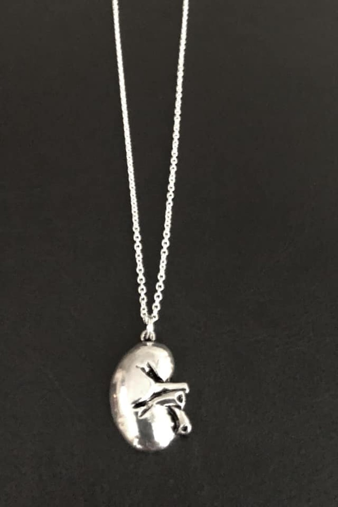 Kidney Necklace Kidney Transplant, Kidney Disease Kidney Donor Gift YOU ...