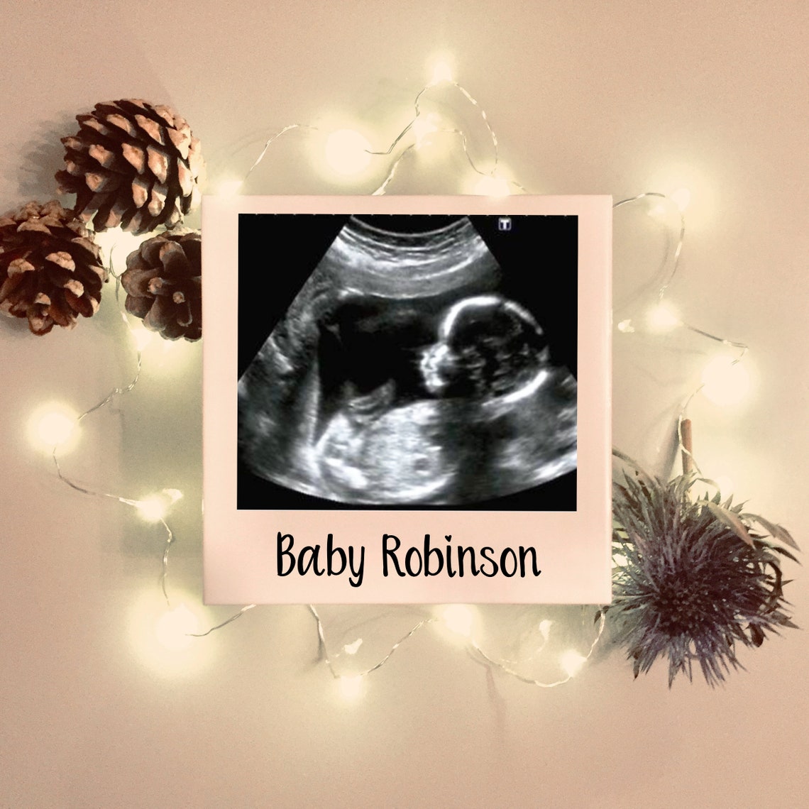 BABY SCAN GIFT Personalised Ceramic Photo & Easel Keepsake - Etsy UK