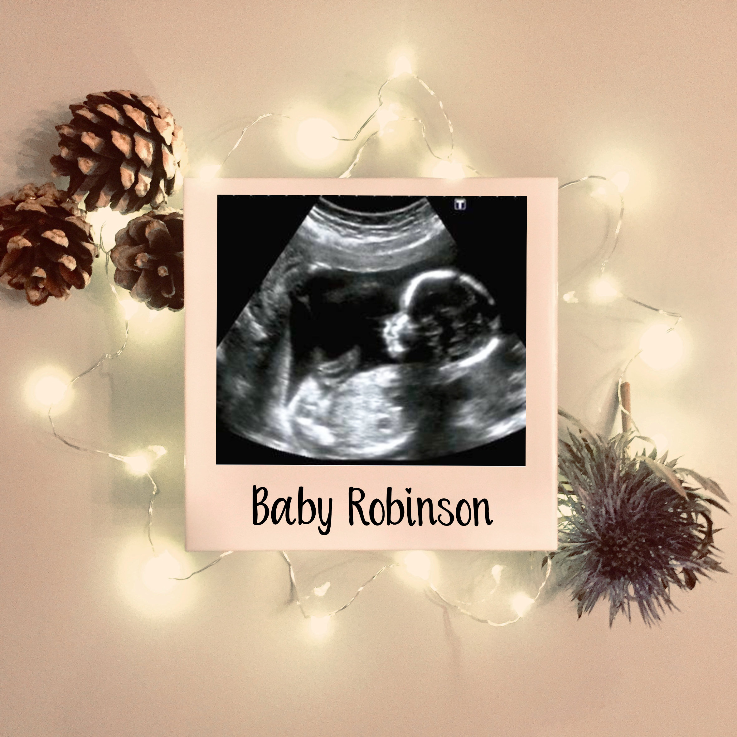 BABY SCAN GIFT Personalised Ceramic Photo & Easel Keepsake - Etsy UK