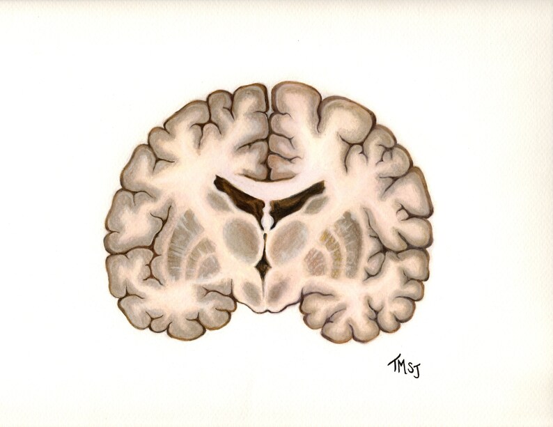 Midbrain Cross-section Drawing - Etsy