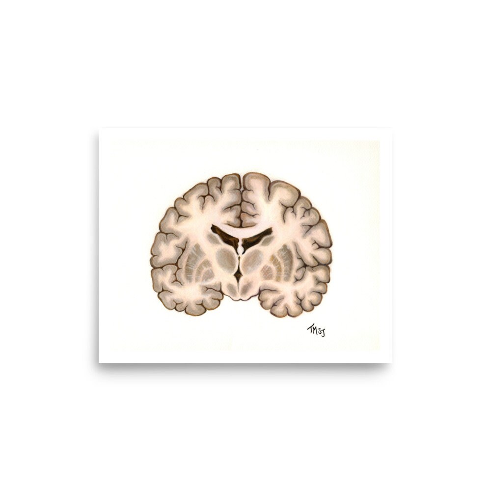 Midbrain Cross-section Drawing - Etsy