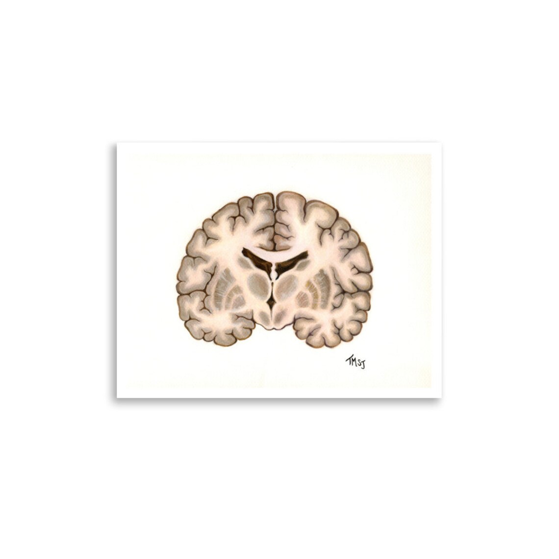 Midbrain Cross-section Drawing - Etsy