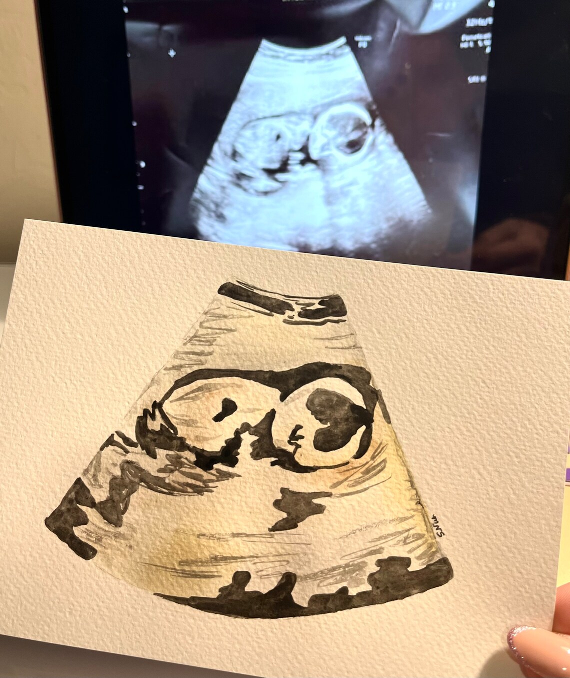 Sonogram Watercolor Painting Sonogram Art Work Baby Shower - Etsy