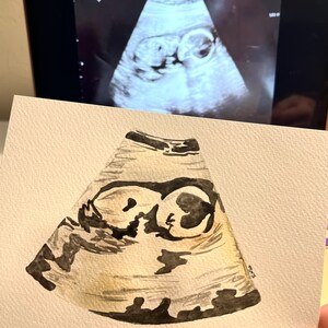 Sonogram Watercolor Painting Sonogram Art Work, Baby Shower Gift, Baby ...