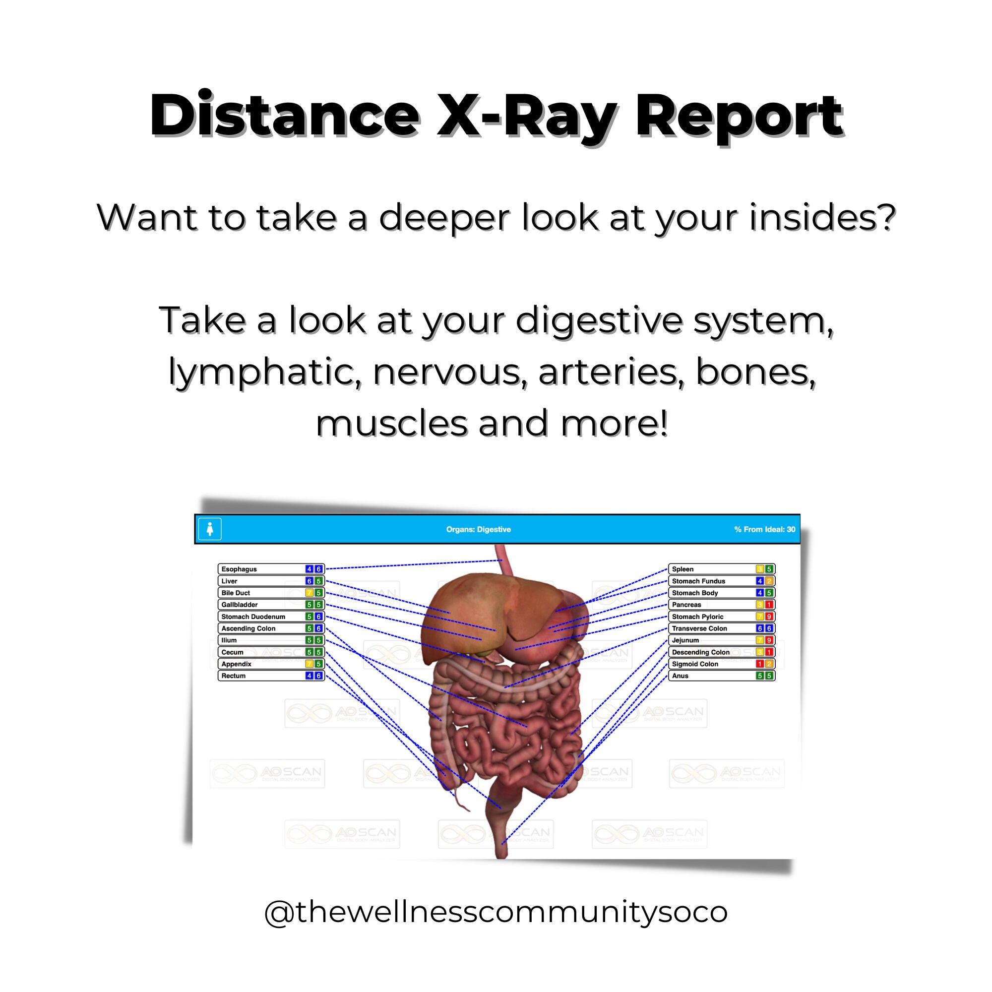Distance Frequency X-ray Report - Etsy