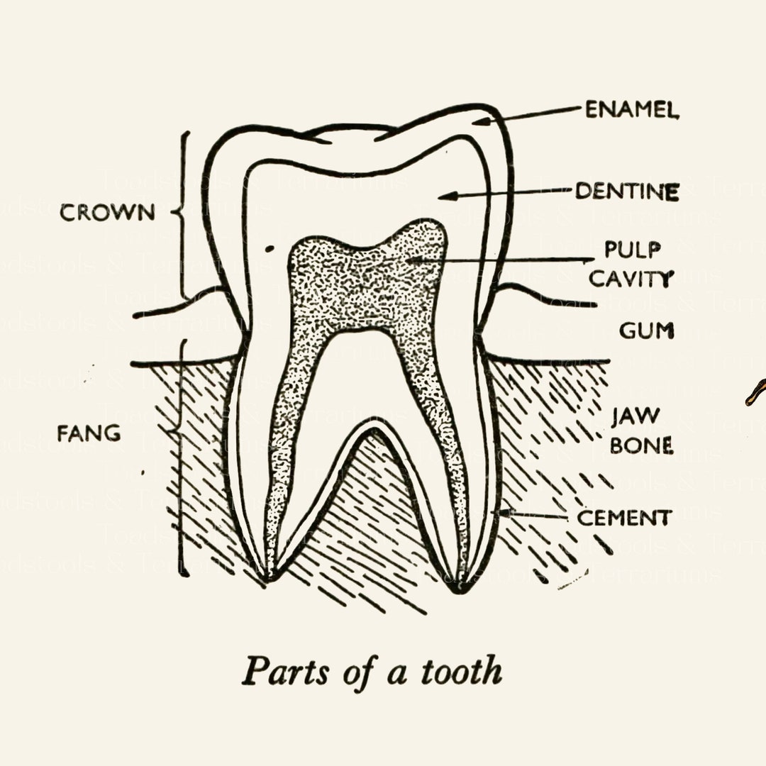 Vintage Tooth Diagram Digital Download - Dental Clipart - Antique Black ...
