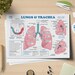 Lungs and Trachea Anatomy Printable Poster - Etsy