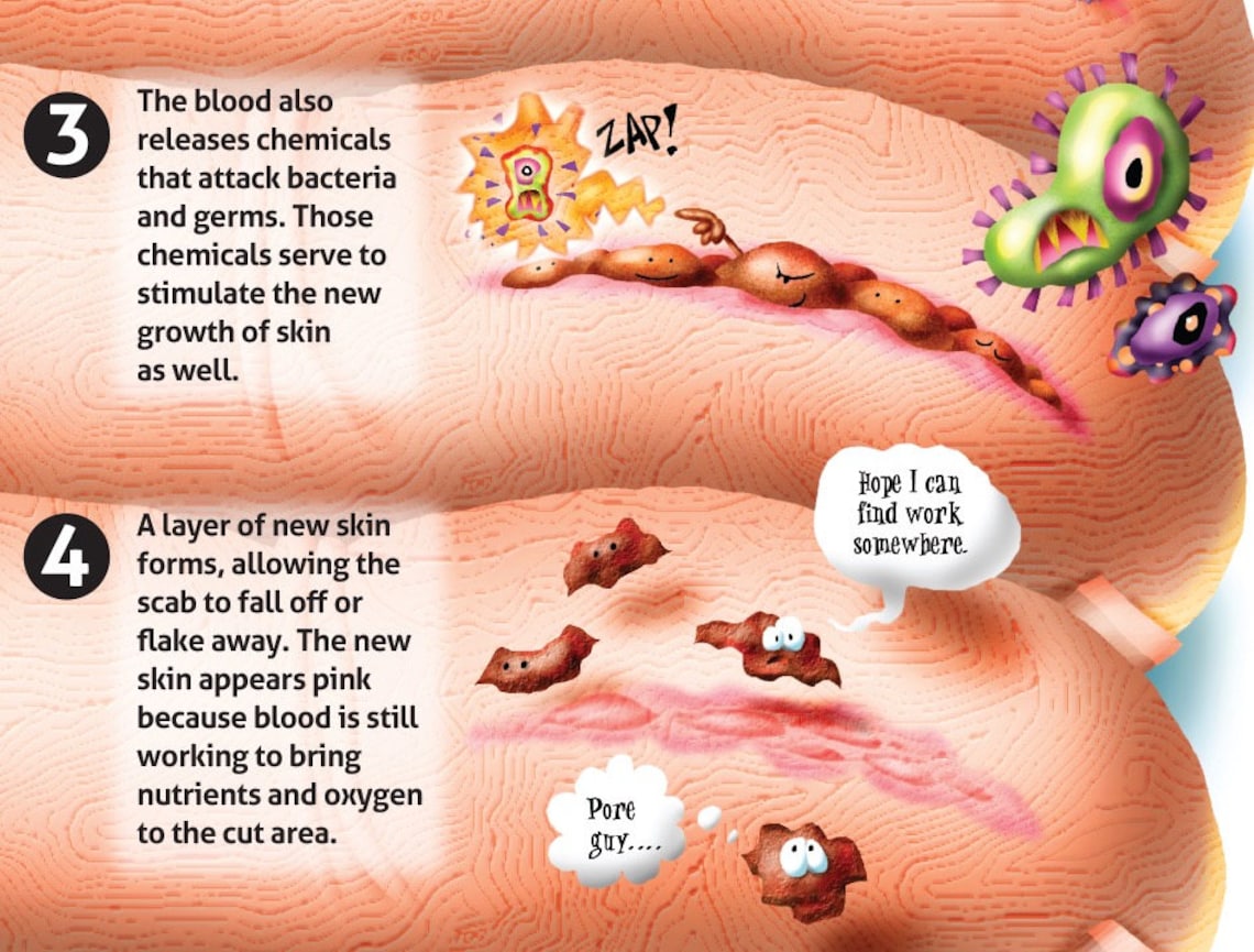 How a Cut Heals Classroom Poster .pdf File - Etsy