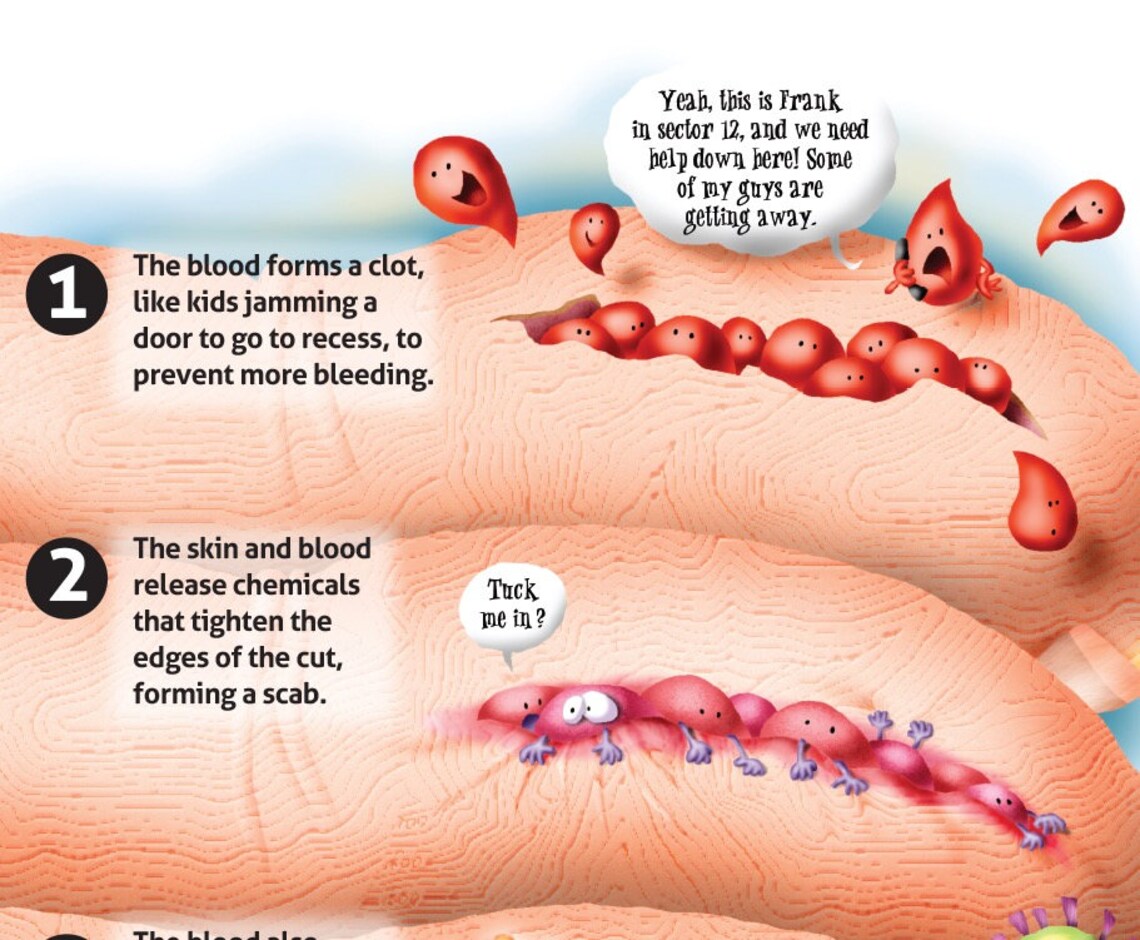 How a Cut Heals Classroom Poster .pdf File - Etsy