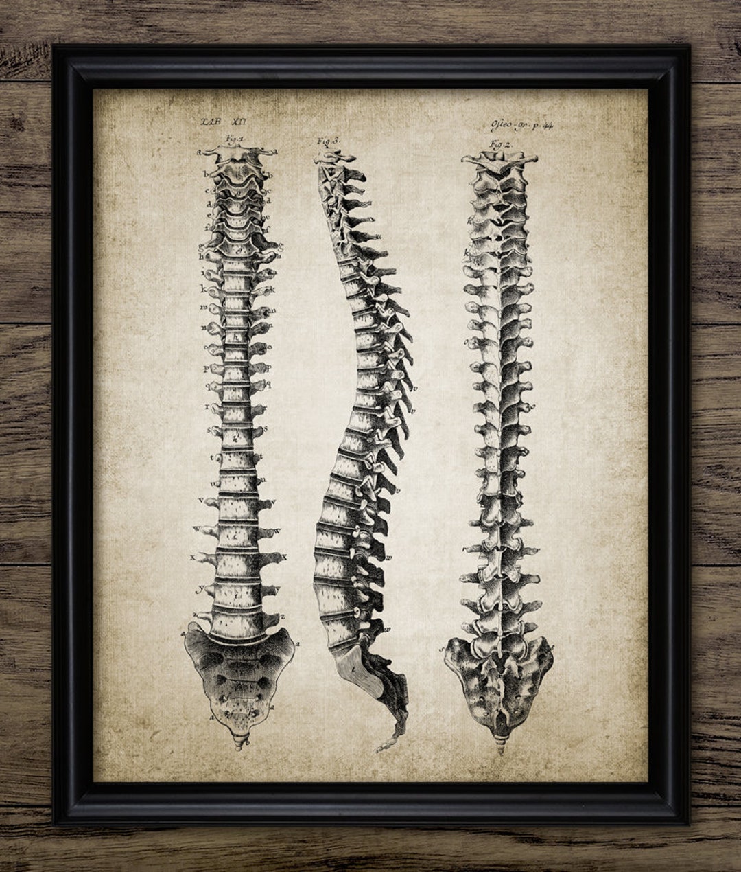 Human Spine Art