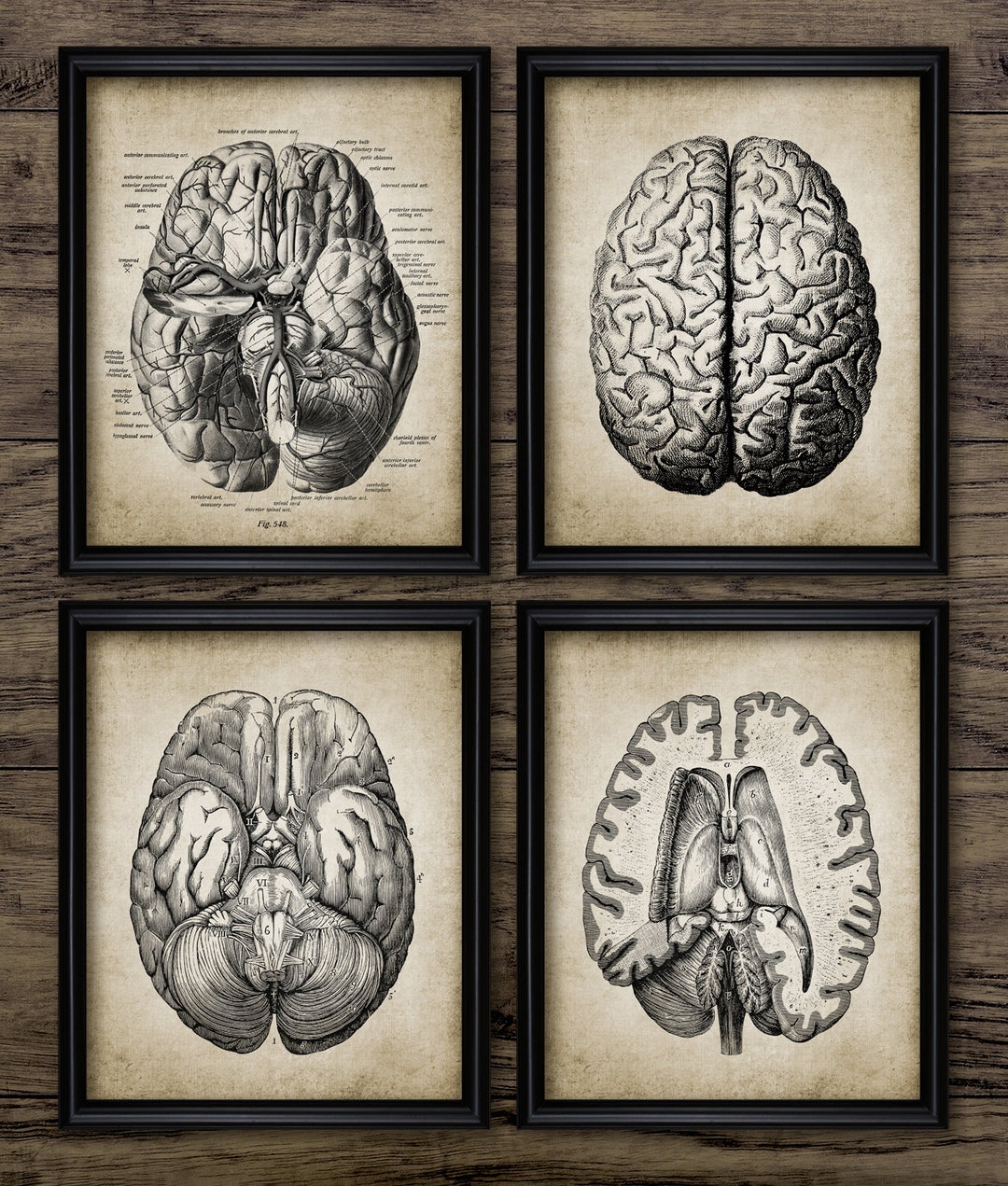 Brain Anatomy Set of 4, Human Brain Anatomy, Neurology Art, Human ...