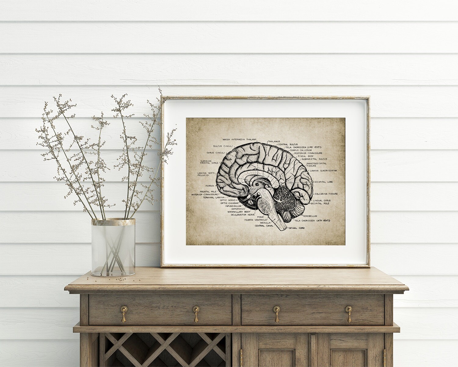 Human Brain Anatomy Wall Art, Printable Brain, Neuroscience ...