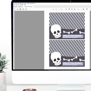 Halloween Treat Bag Toppers Printable File With Skeleton Bones in Black ...