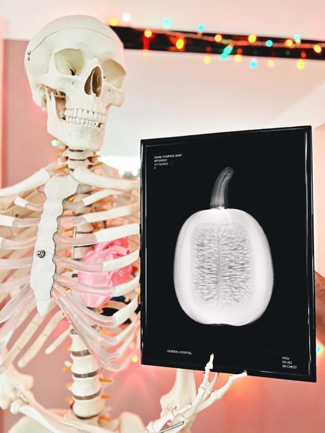 A6 Limited Edition Pumpkin X-ray Print - Etsy