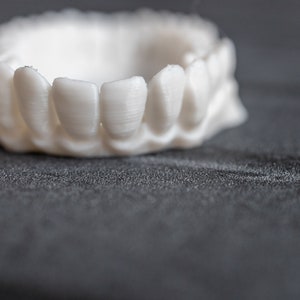 Teeth Bowl - Tooth Jewellery Holder - Tooth Ring Dish - Dentist Gift ...