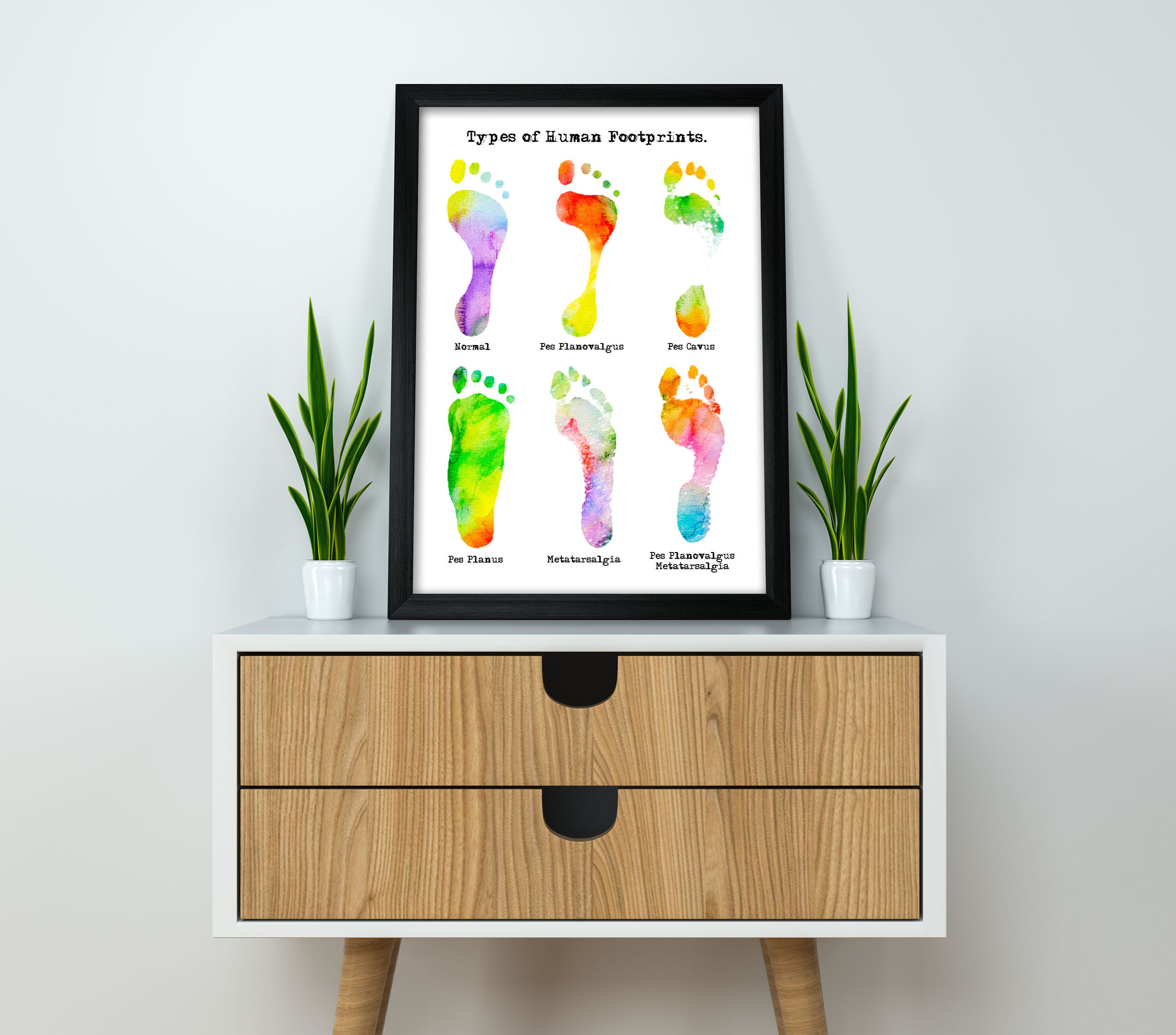 Podiatry Gift Types of Footprints Orthopedics Art Print - Etsy